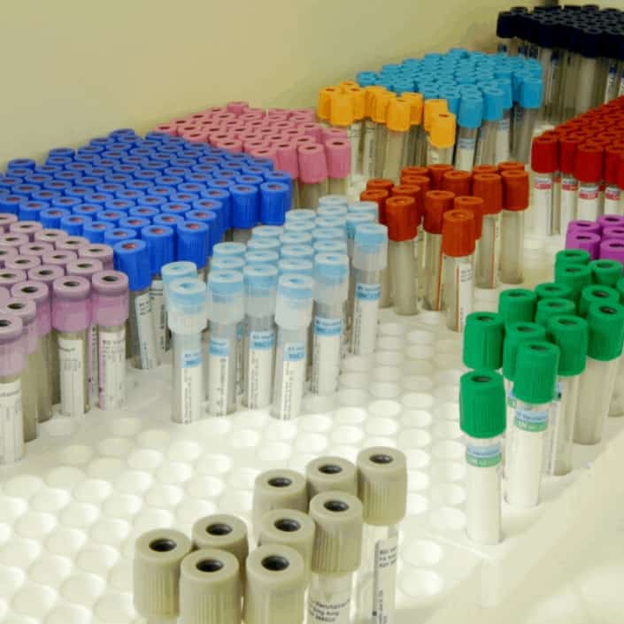 phlebotomy order of draw tips - PhlebotomyU