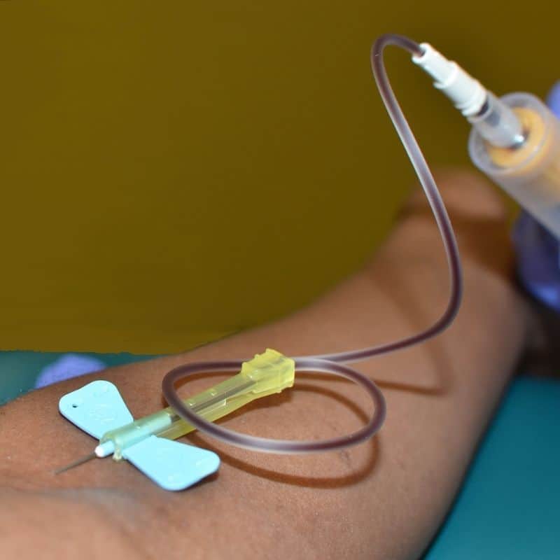 Butterfly Venipuncture 47 OFF Ids deutschland de Butterfly Venipuncture 47 OFF Ids deutschland de